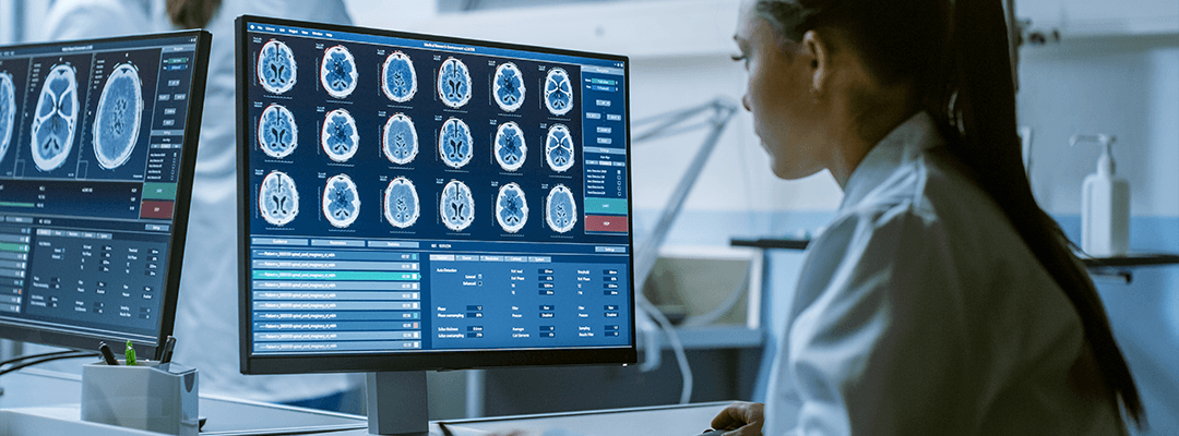 TBI Research Lessons: 5 Tips for Managing Complex Data Sets